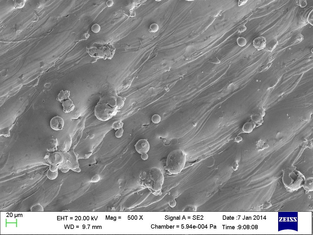 3D Dental laser printed CoCr Partials